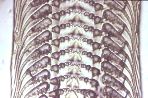 Mollusc Radulae from microscope slides at the Booth Museum, Brighton