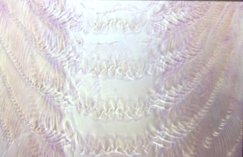 Mollusc Radulae from microscope slides at the Booth Museum, Brighton